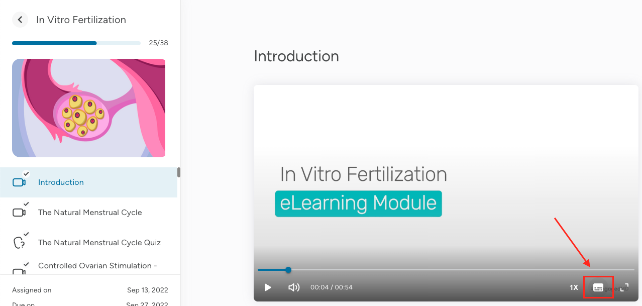 Closed Captioning and Transcripts – CareXP